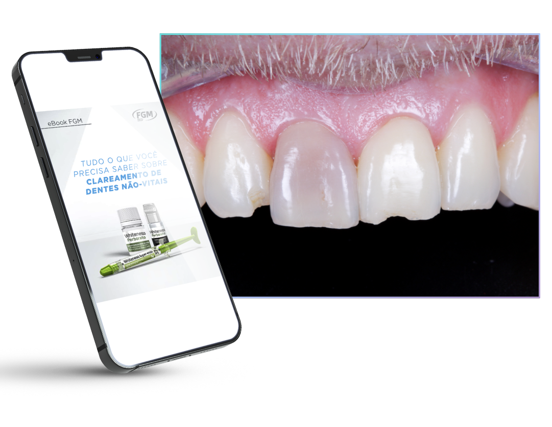 Whitening E-books - FGM Dental Group